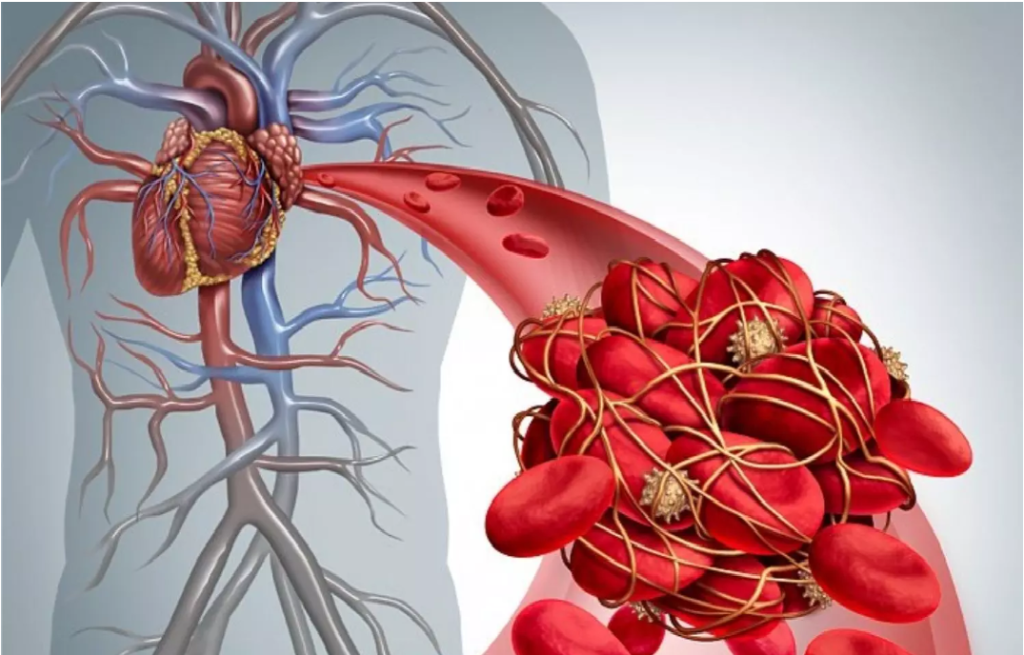 Todo sobre el último seminario del año: Escalas de calidad de vida en ...